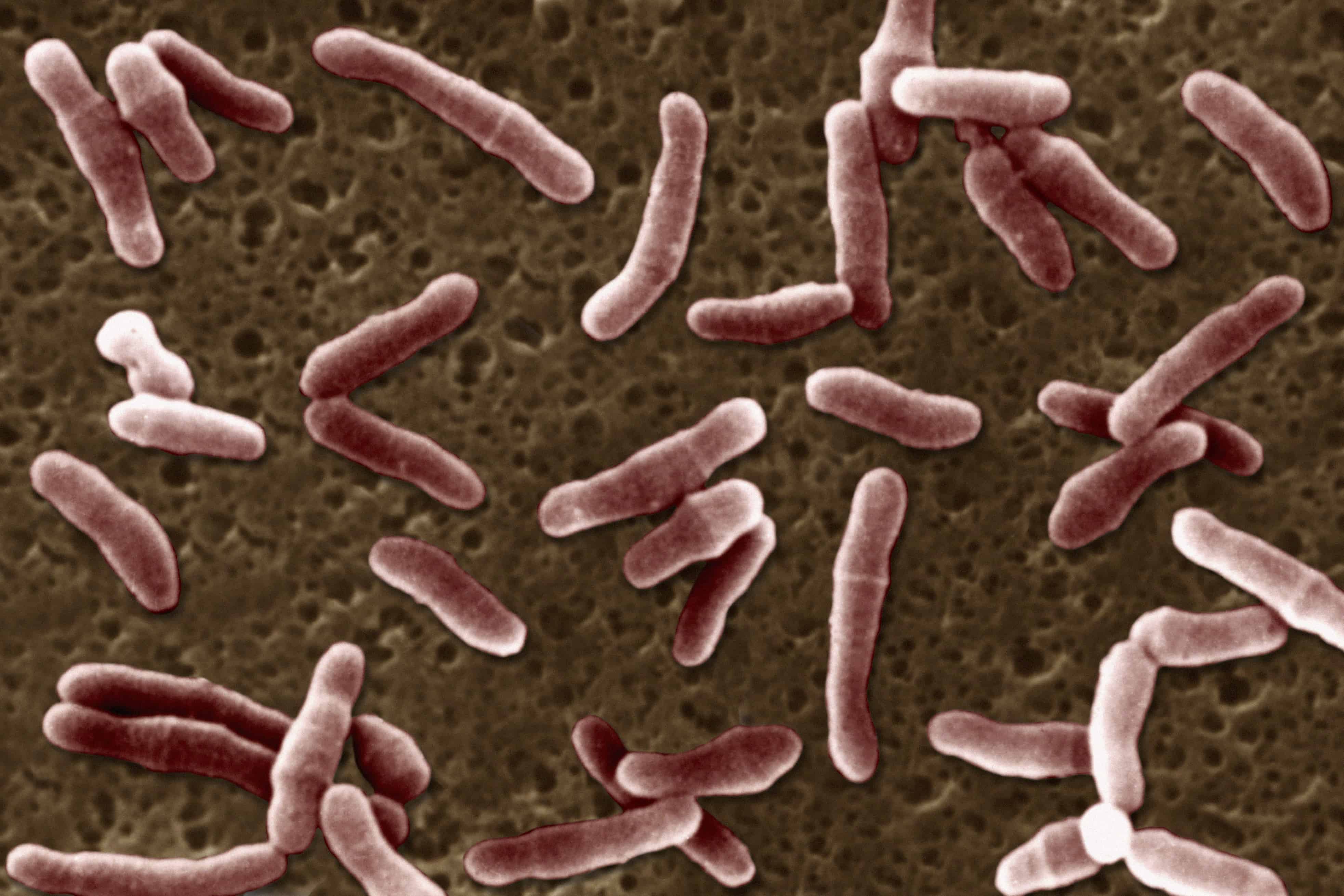 Growing Bacteria in Agar Activity with Free Lesson Printable - The ...