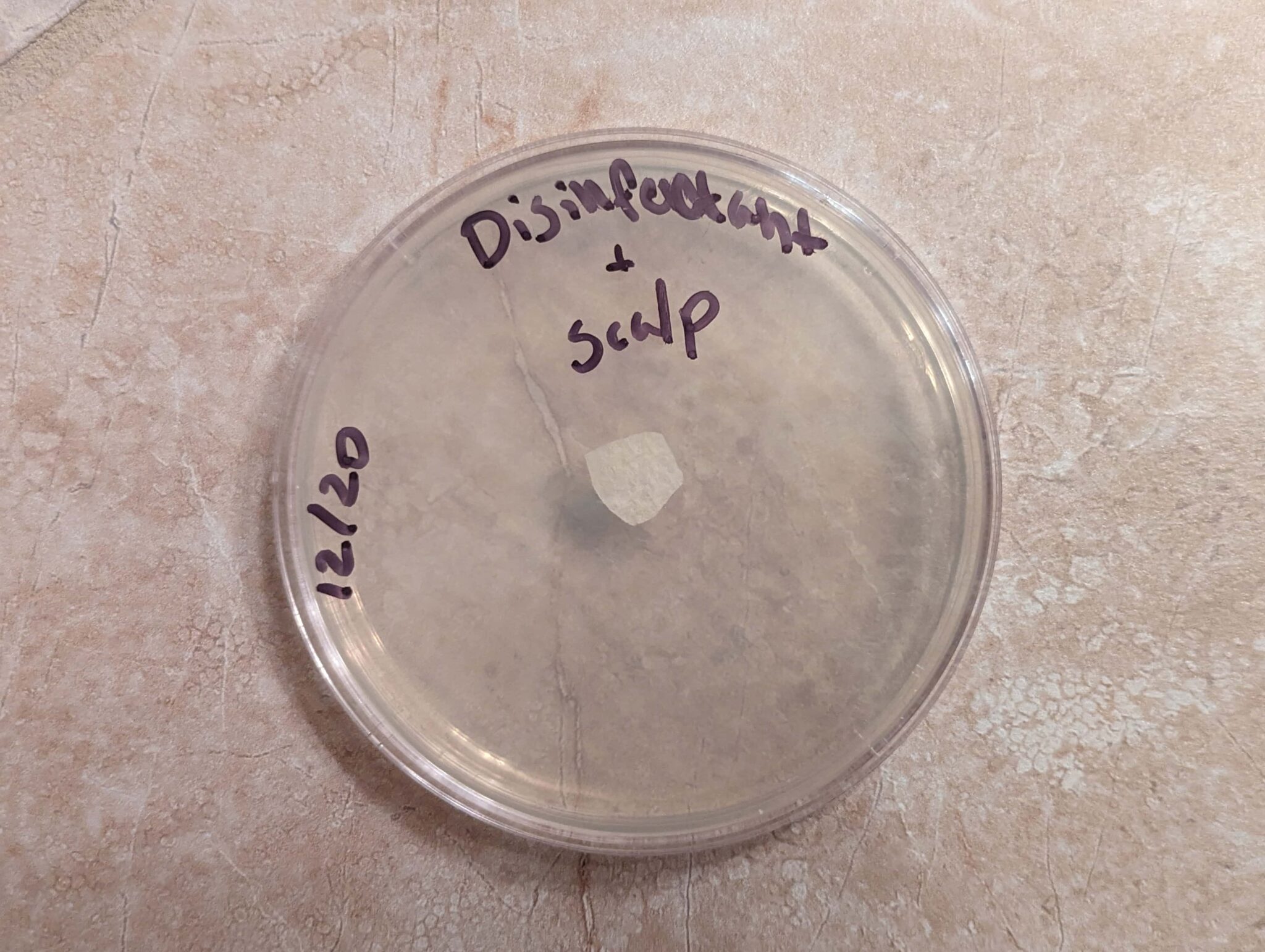 Growing Bacteria in Agar Activity with Free Lesson Printable - The ...