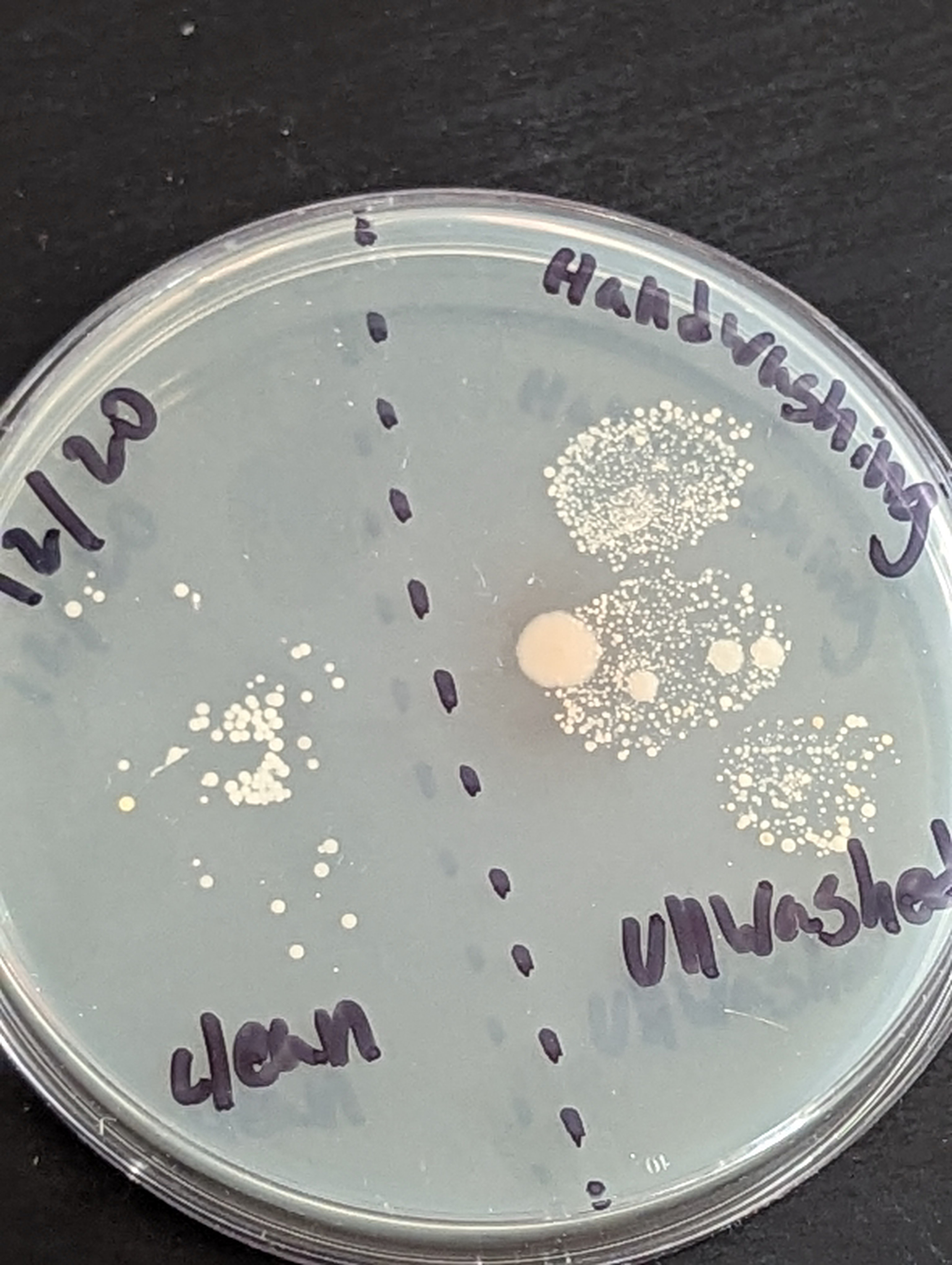 Growing Bacteria in Agar Activity with Free Lesson Printable - The ...